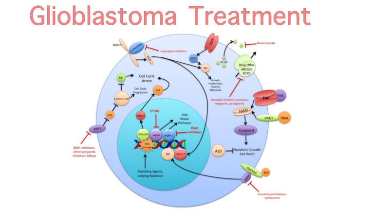 Glioblastoma Treatment - IMC Grupo